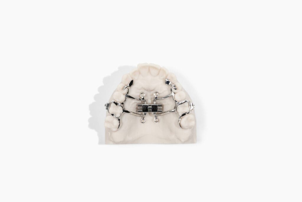 MARPE vs MSE: Which Palatal Expander is Right for You? | ODL ...