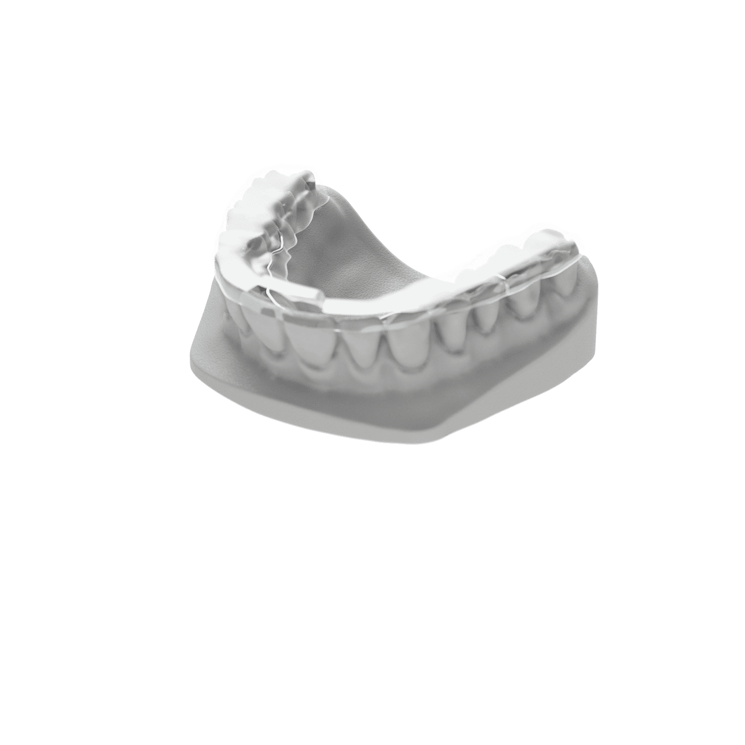 Digital Deprogramming Splint | ODL Orthodontic Labs