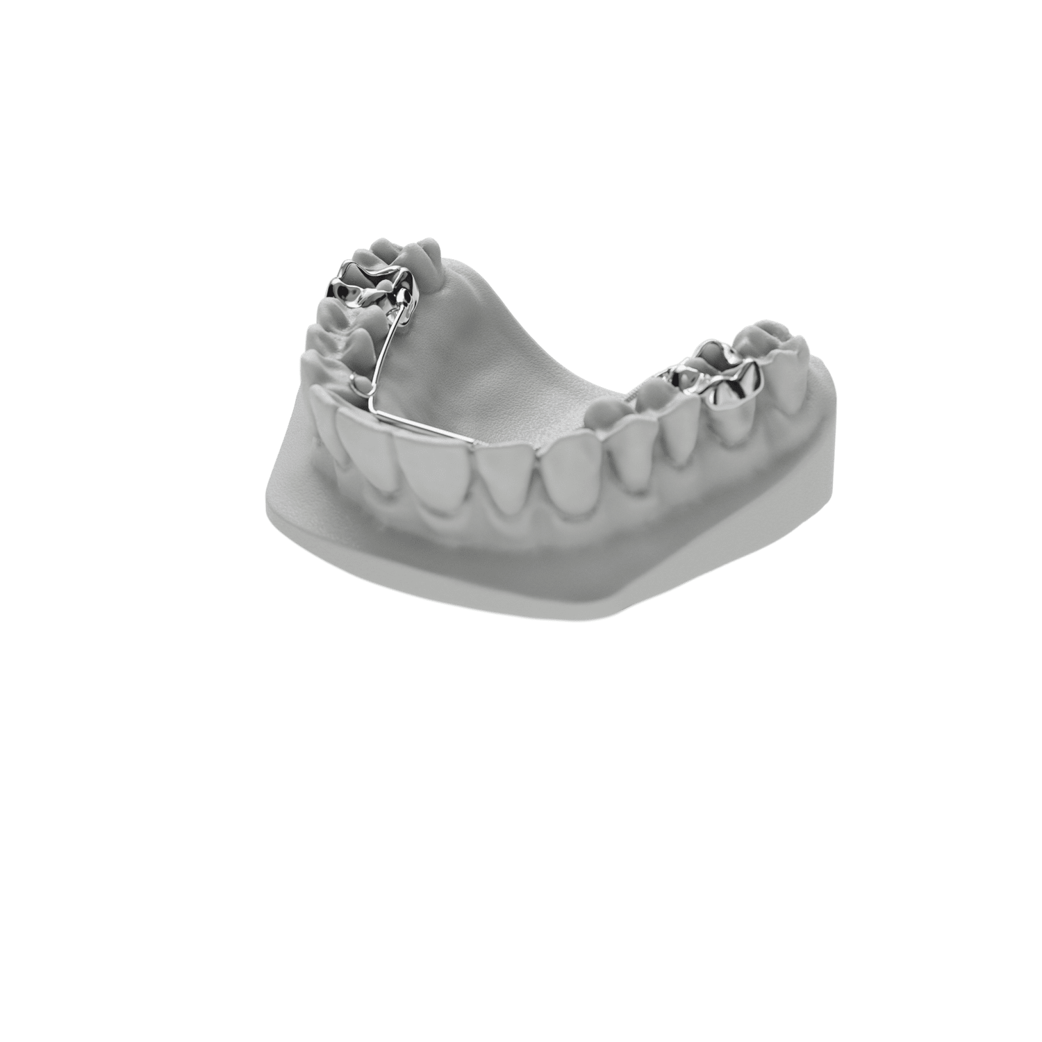 Lower E-Arch (Arnold Expander) | ODL Orthodontic Labs