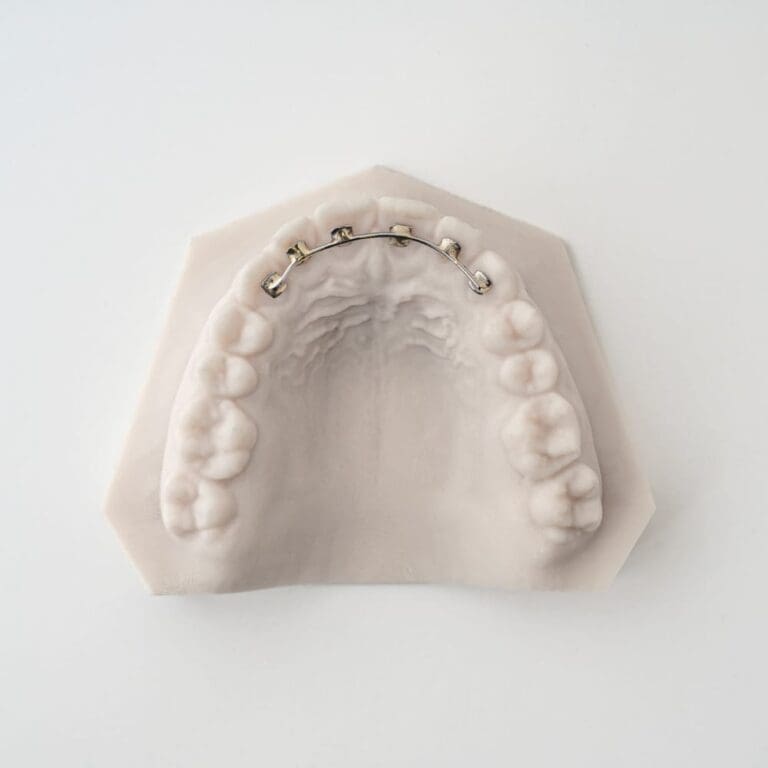 Leaf Spring Self Activated Expander | ODL Orthodontic Labs