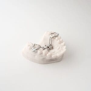 TAD Appliances for Airway Expansion | ODL Orthodontic Labs