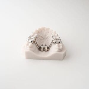 TAD Appliances for Airway Expansion | ODL Orthodontic Labs