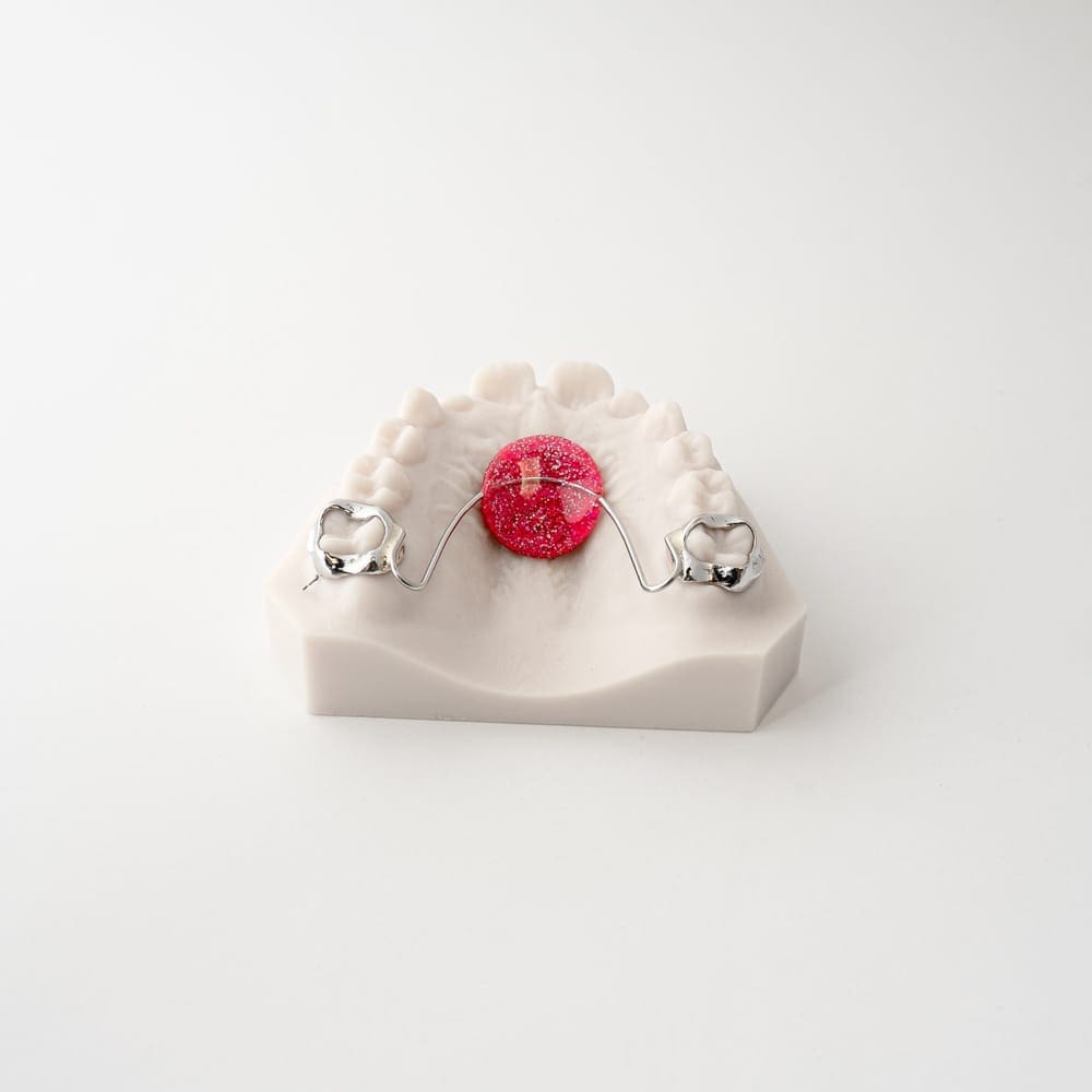 Nance Appliance: Revolutionizing Orthodontic Care with Precision ...