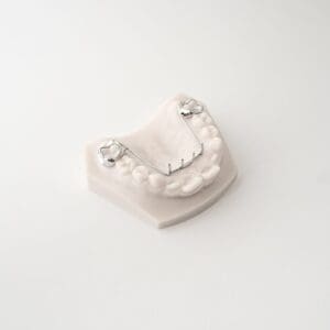 Habit Breaking Appliances | ODL Orthodontic Labs