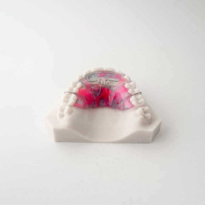 Super Spring Aligner | ODL Orthodontic Labs