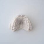 Theroux Phase 1 Retainer | ODL Orthodontic Labs