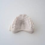 Theroux Phase 1 Retainer | ODL Orthodontic Labs