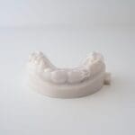 Theroux Phase 1 Retainer | ODL Orthodontic Labs