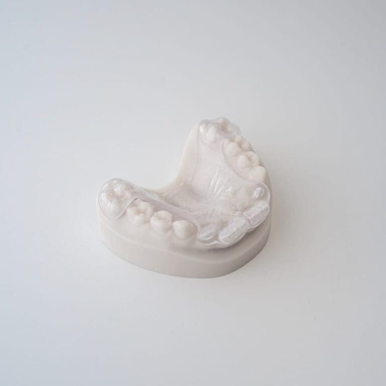 Theroux Phase 1 Retainer | ODL Orthodontic Labs
