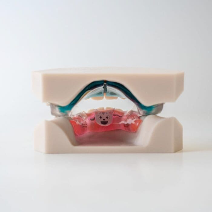 Theroux Phase 1 Retainer | ODL Orthodontic Labs