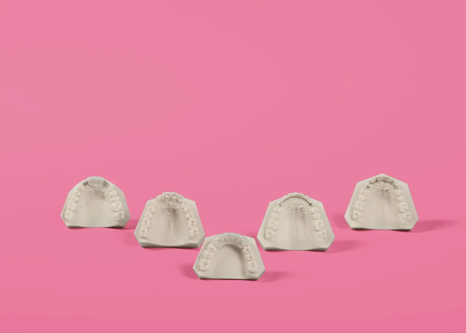 Lingual Retainers: Your Invisible Solution for Permanent Teeth ...