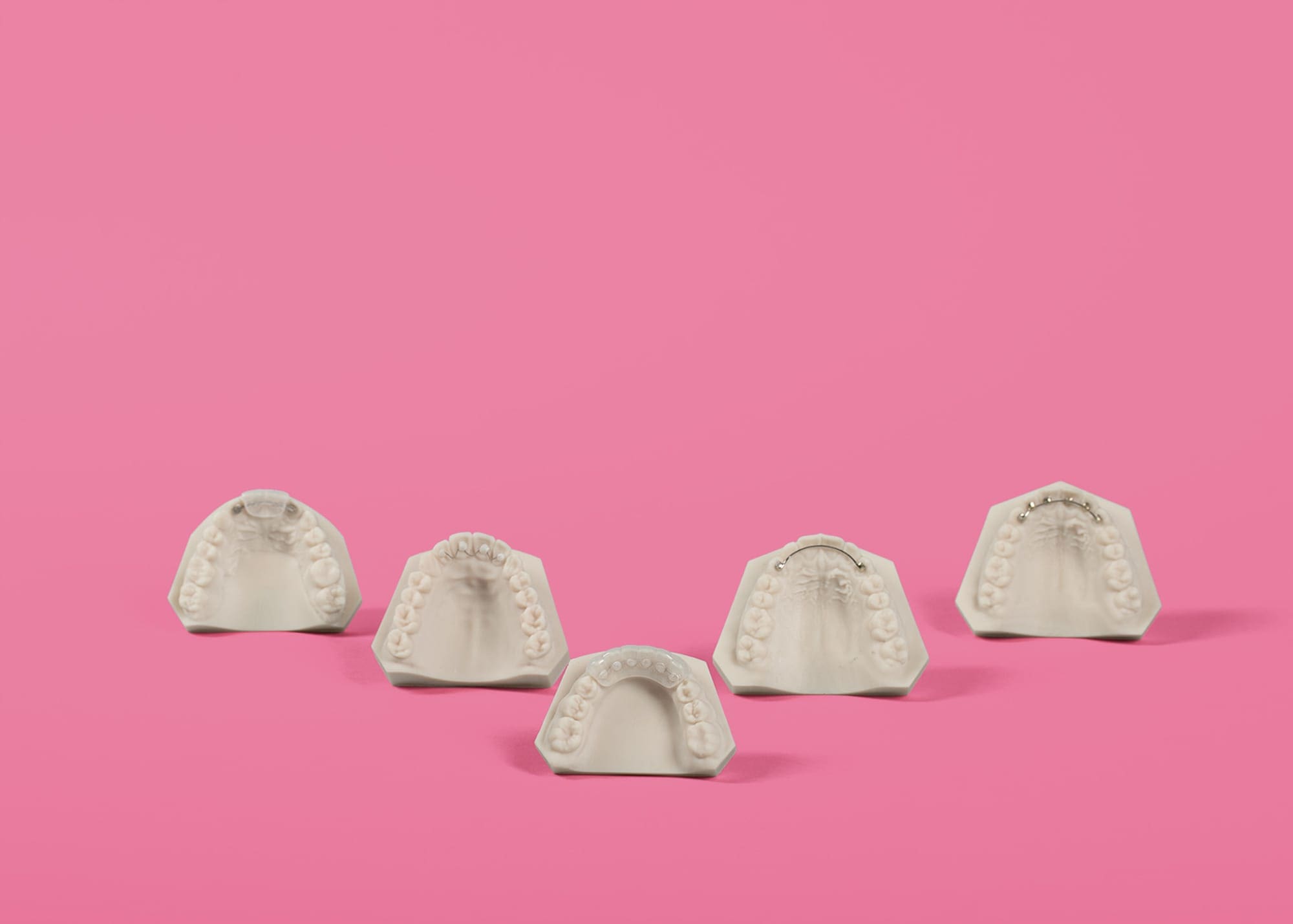 Lingual Retainers: Your Invisible Solution for Permanent Teeth ...