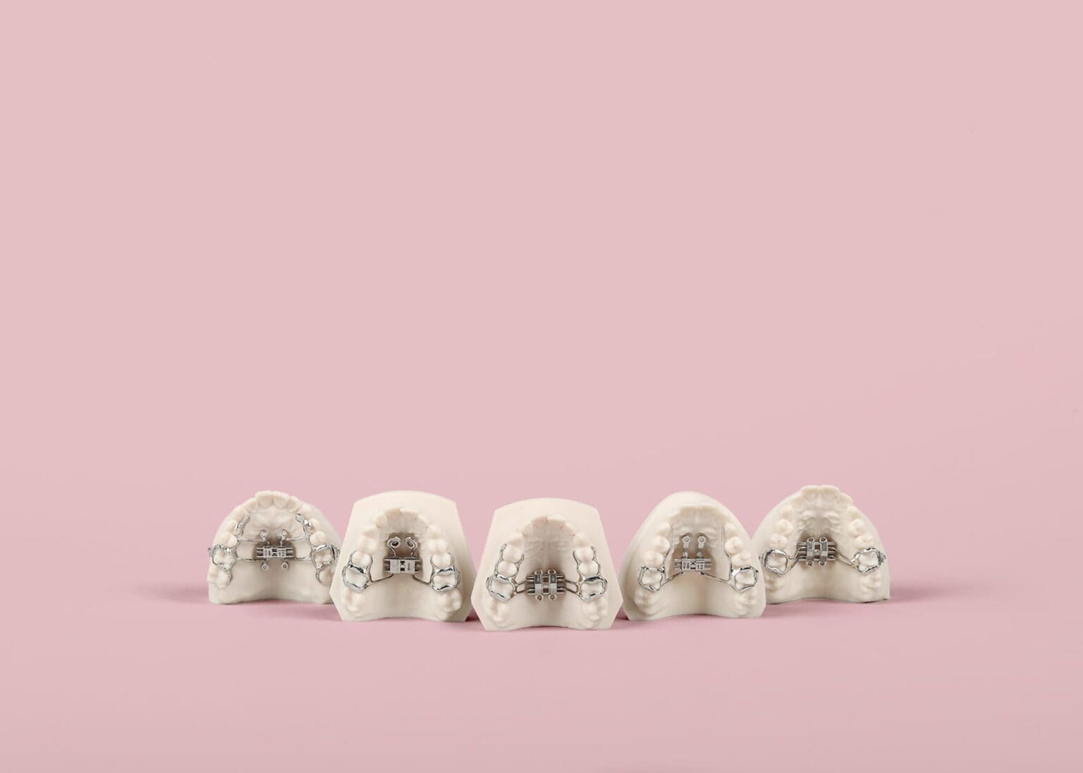 TAD Appliances for Airway Expansion | ODL Orthodontic Labs