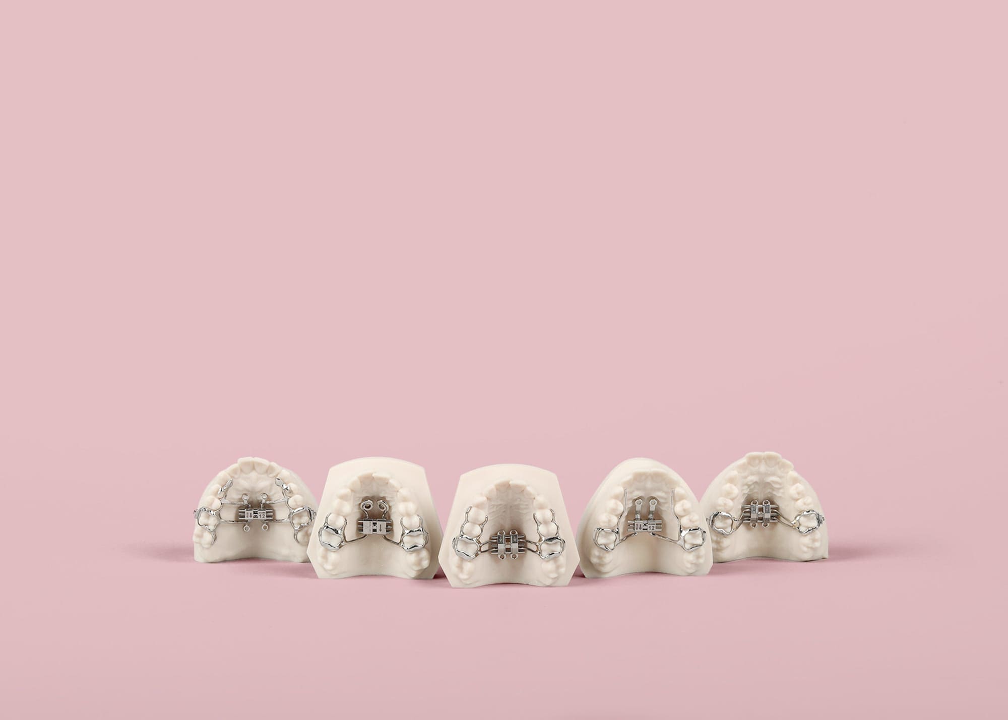 TAD Appliances for Airway Expansion | ODL Orthodontic Labs