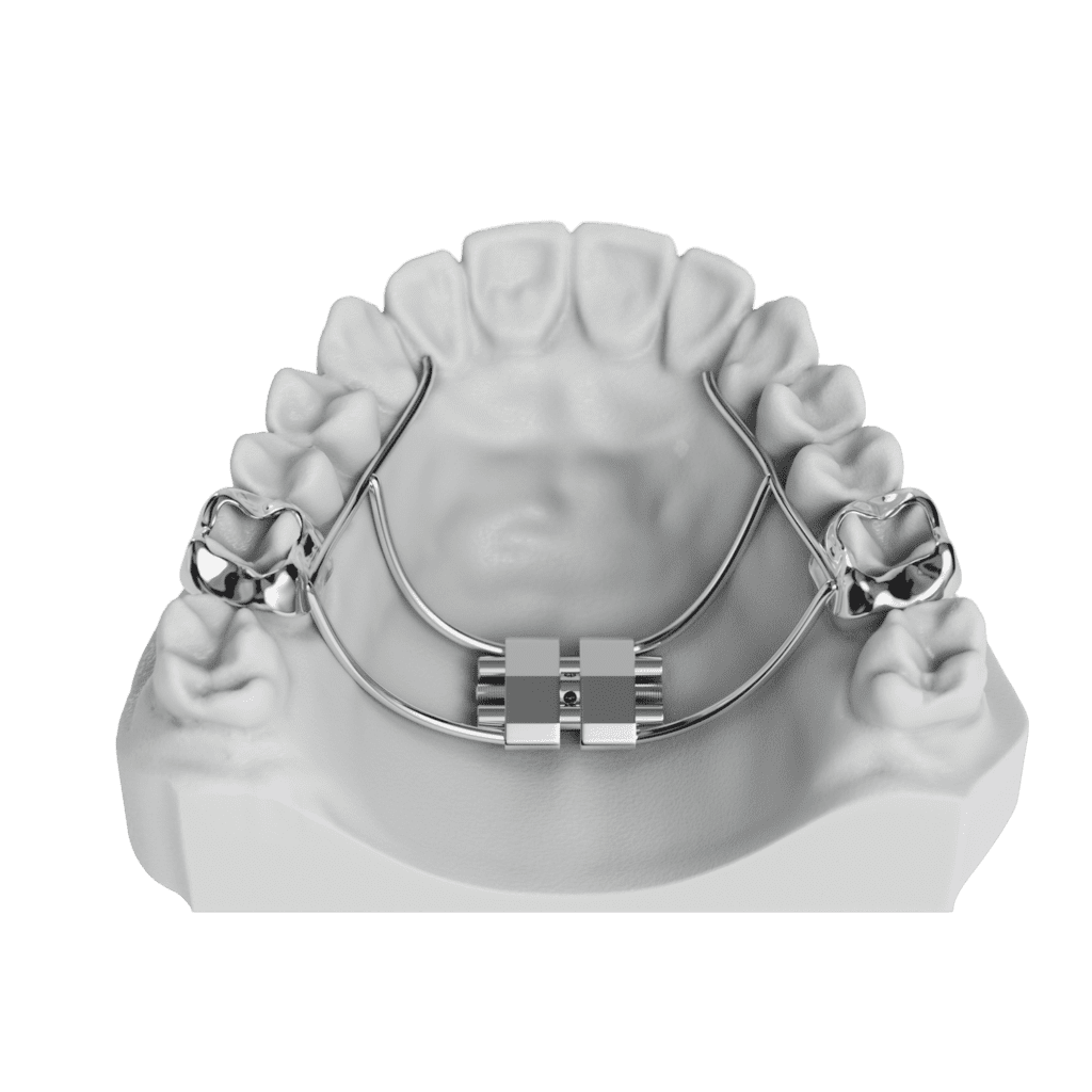 Space Maintainer | ODL Orthodontic Labs