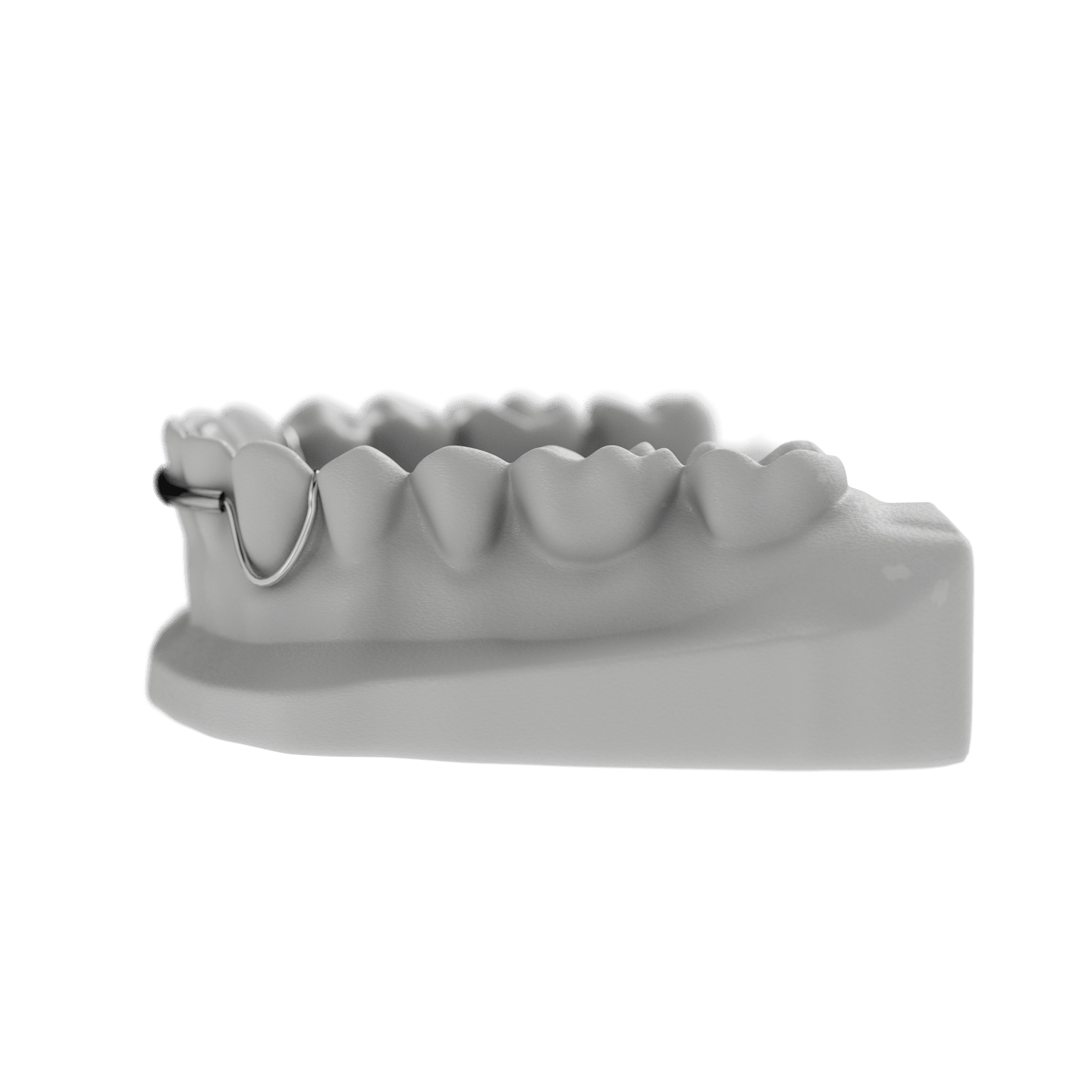 Spring Clip | ODL Orthodontic Labs