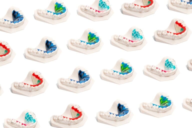 Hawley Wraparound | ODL Orthodontic Labs