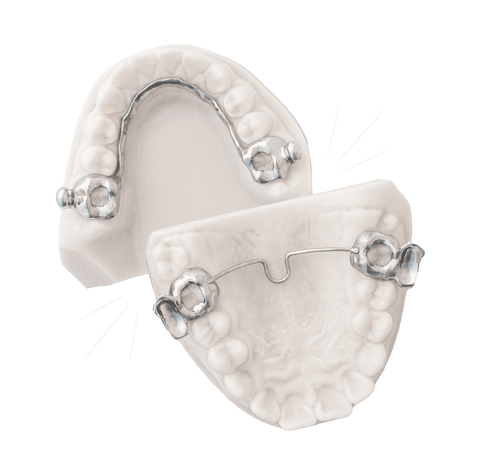 Inside Casper: Clinical Strategies & Applications | ODL Orthodontic Labs